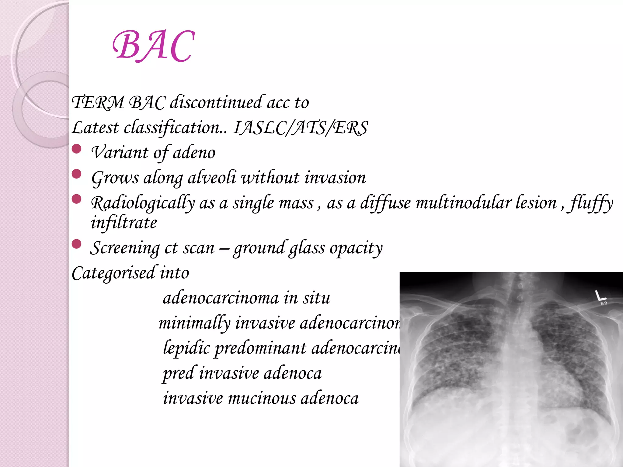 ANATOMY,PATHOLOGY, INVESTIGATIVE WORK –UP AND STAGING OF LUNG CANCER | PPT