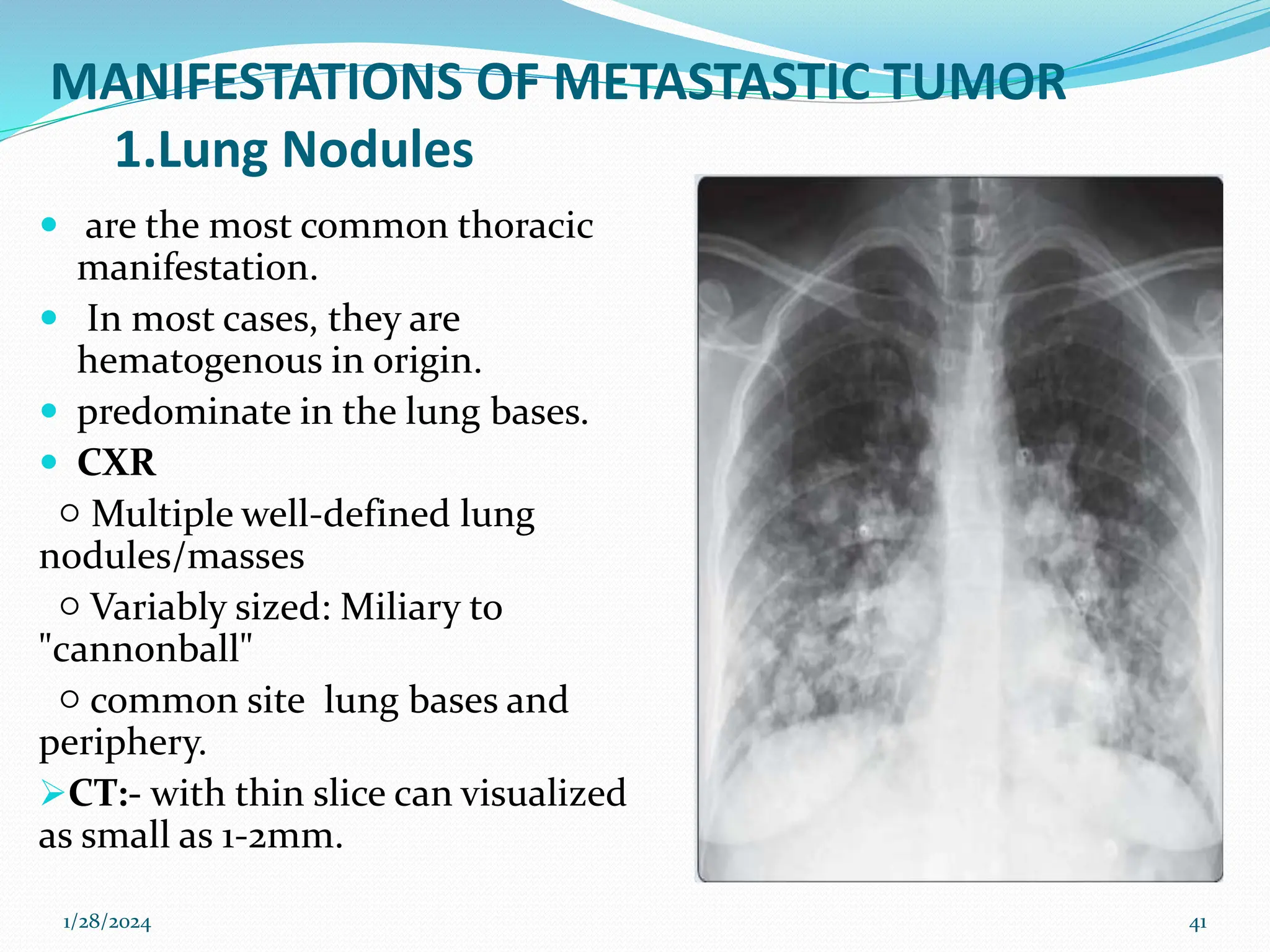 Lung Cancer and bronchopulmonary neoplasia | PPTX