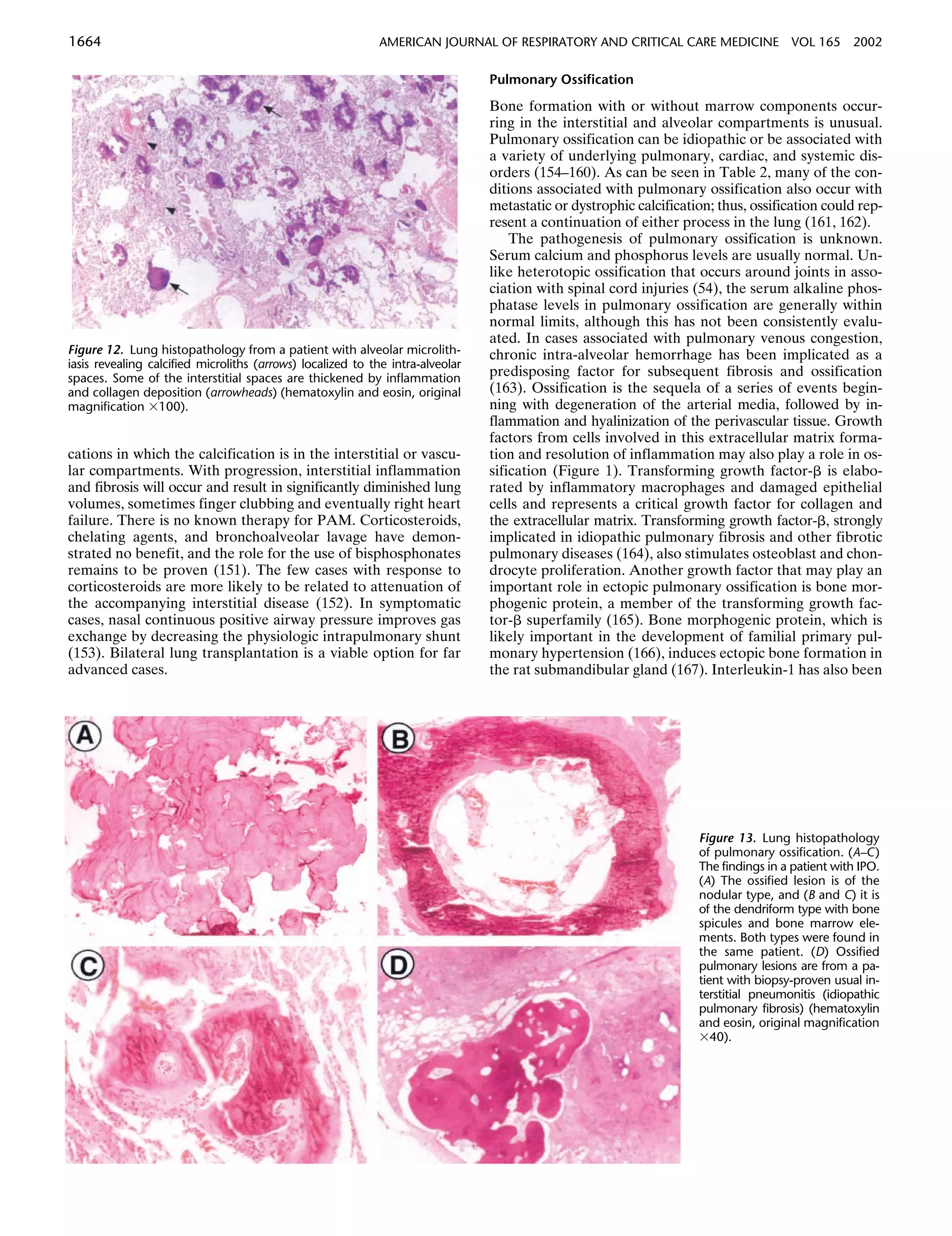 Lung calcium ajrccm.full