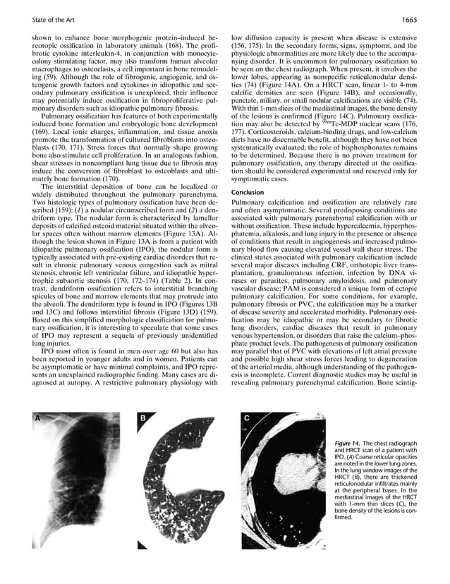 Lung calcium ajrccm.full