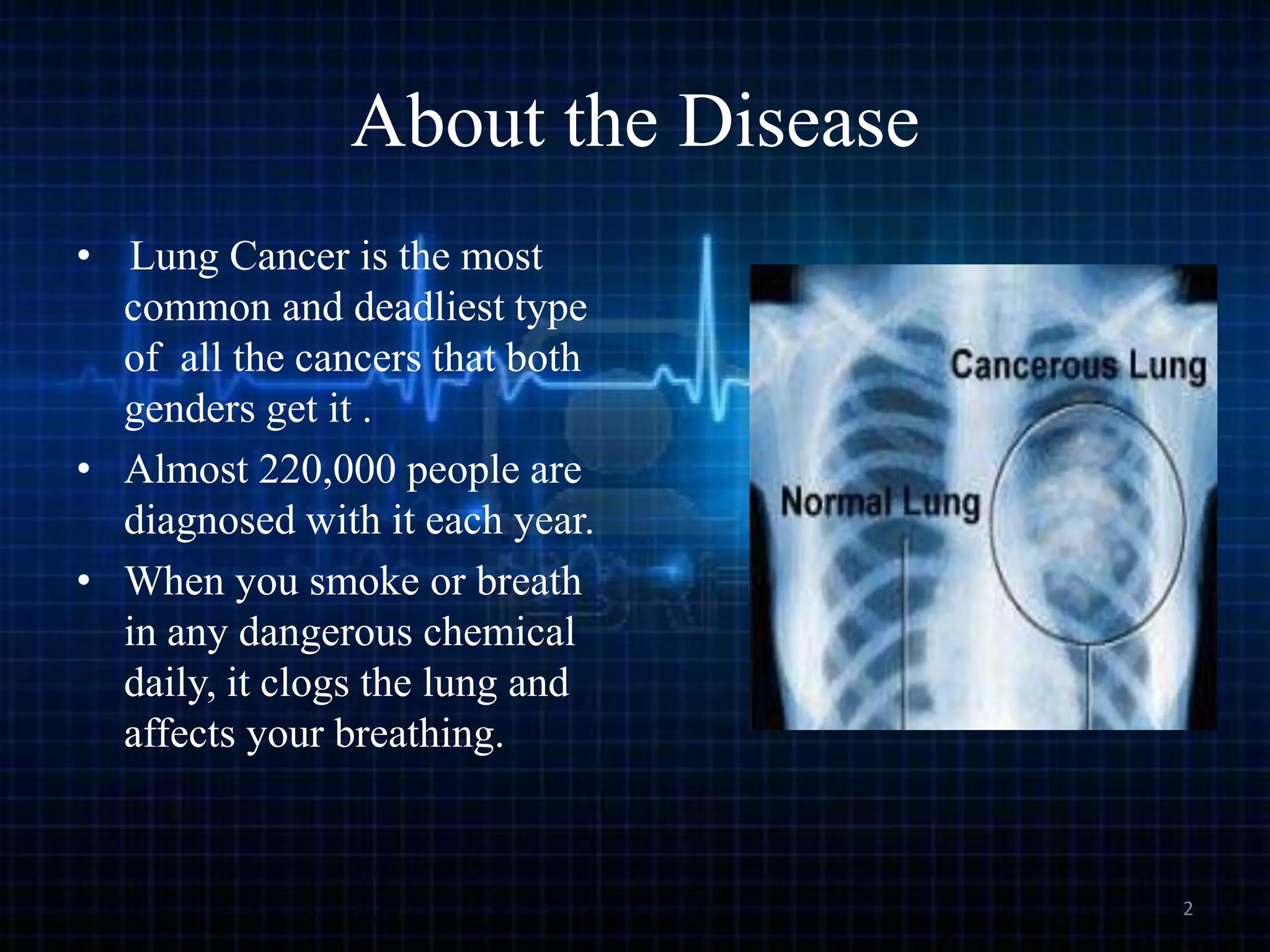 Lung cancer | PPTX