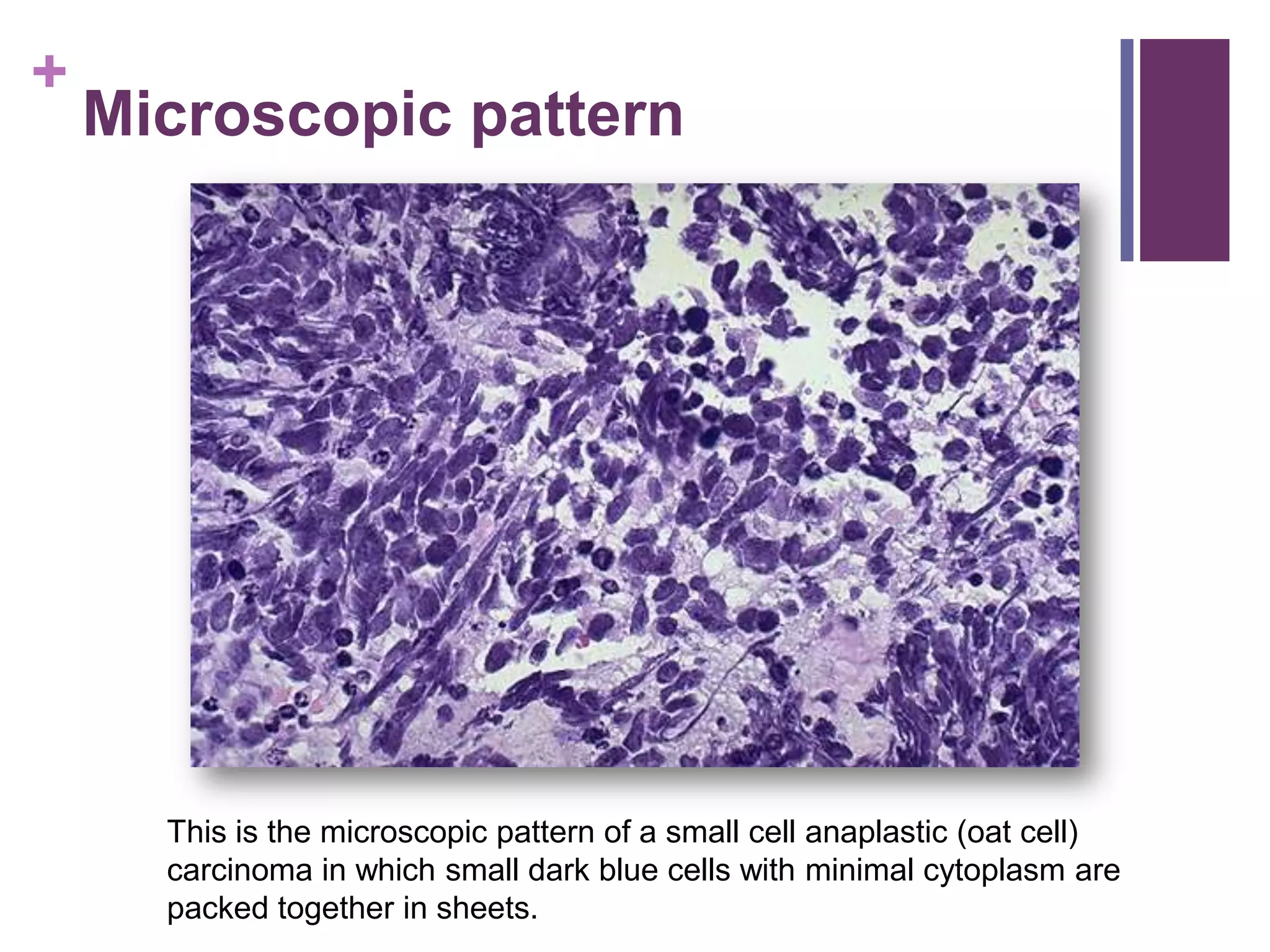 Lung Cancer Pathology & Clinical | PPTX