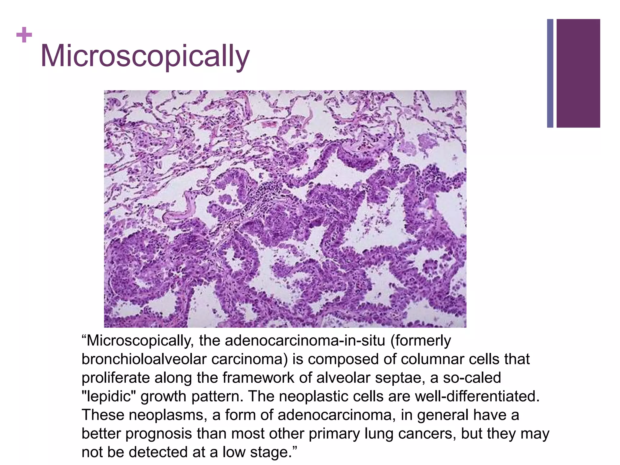 Lung Cancer Pathology & Clinical | PPTX