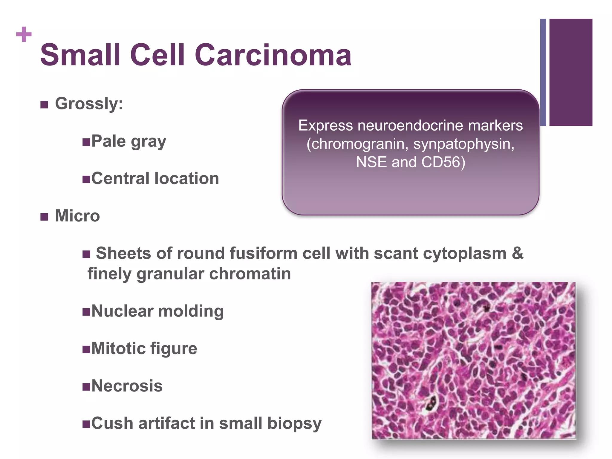 Lung Cancer Pathology & Clinical | PPTX