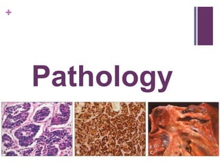 Lung Cancer Pathology & Clinical | PPTX