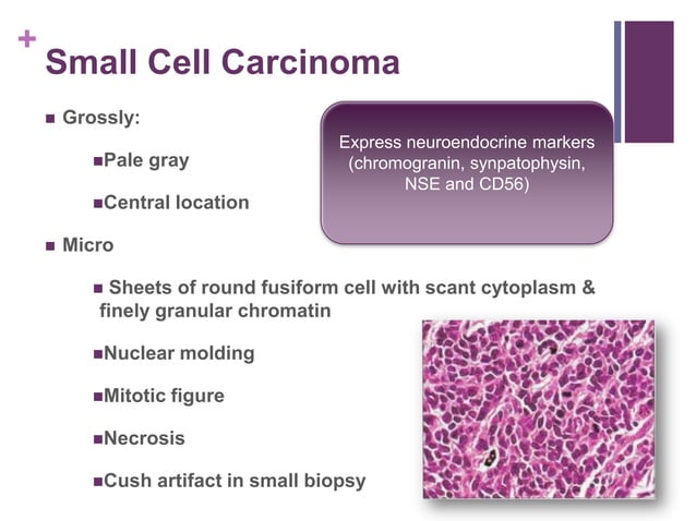 Lung Cancer Pathology & Clinical | PPTX