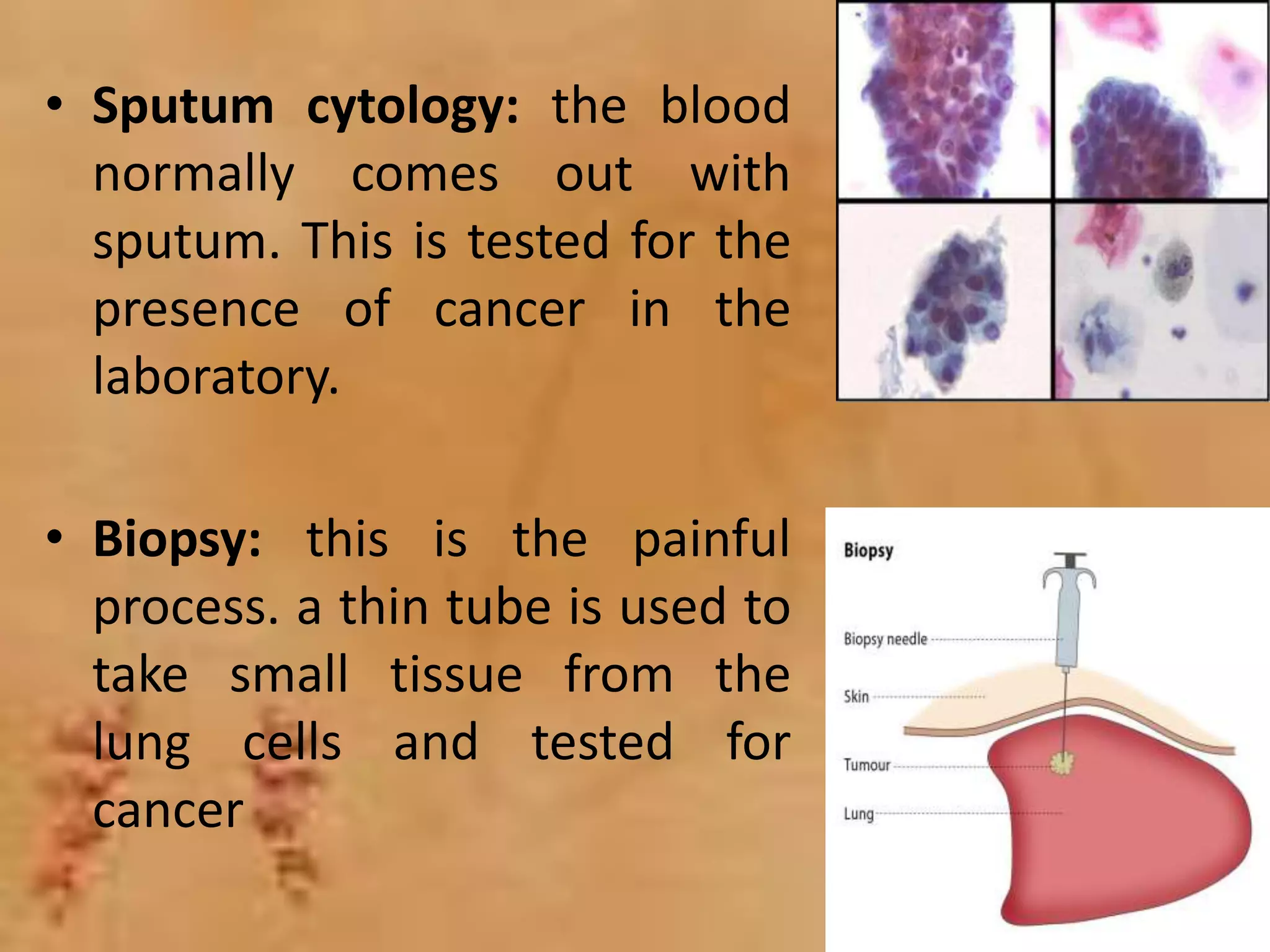 Lung and lung cancer symptoms - an overview | PPTX