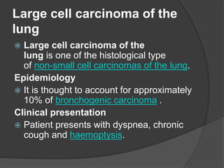 Lung cancer radiology | PPTX
