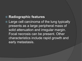 Lung cancer radiology | PPTX