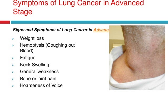 Early Symptoms Diagnosis And Detection Of Lung Cancer Drprof A