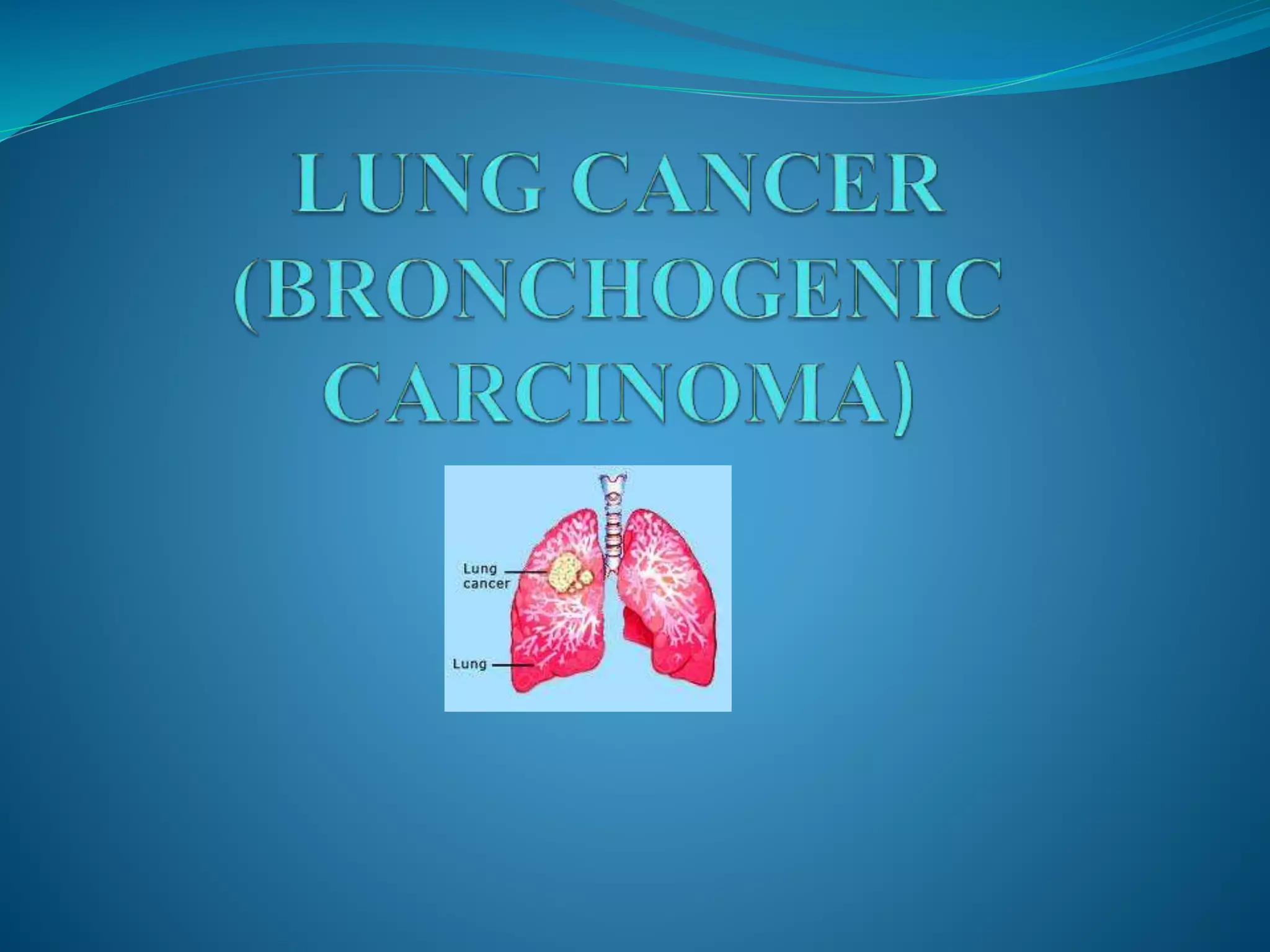 Lung cancer | PPT
