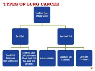 Lung cancer | PPTX