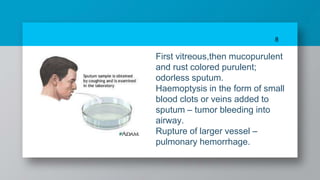 Lung Cancer | PPT