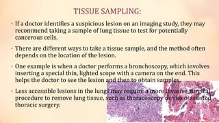 Lung cancer-medical discussion | study | PPT