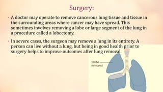 Lung cancer-medical discussion | study | PPTX