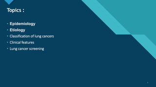 Lung cancer | PPT