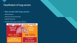 Lung cancer | PPTX