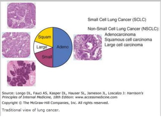 Lung Cancer.pptx