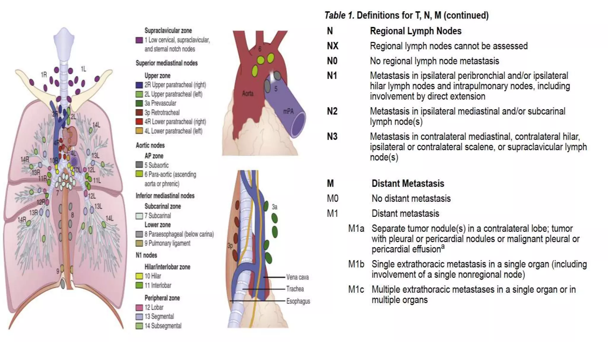 Classification and staging of Lung Cancer.pptx