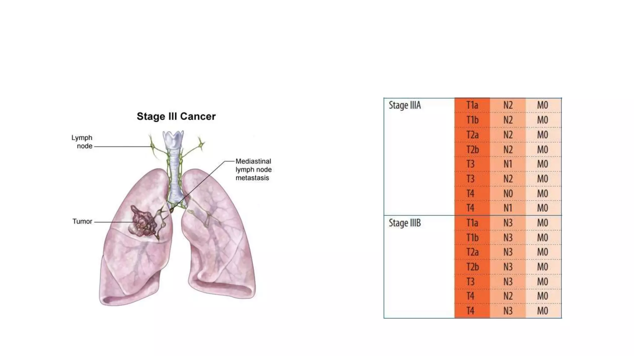 Lung cancer anatomy to pathological classification | PPTX | Lung and ...