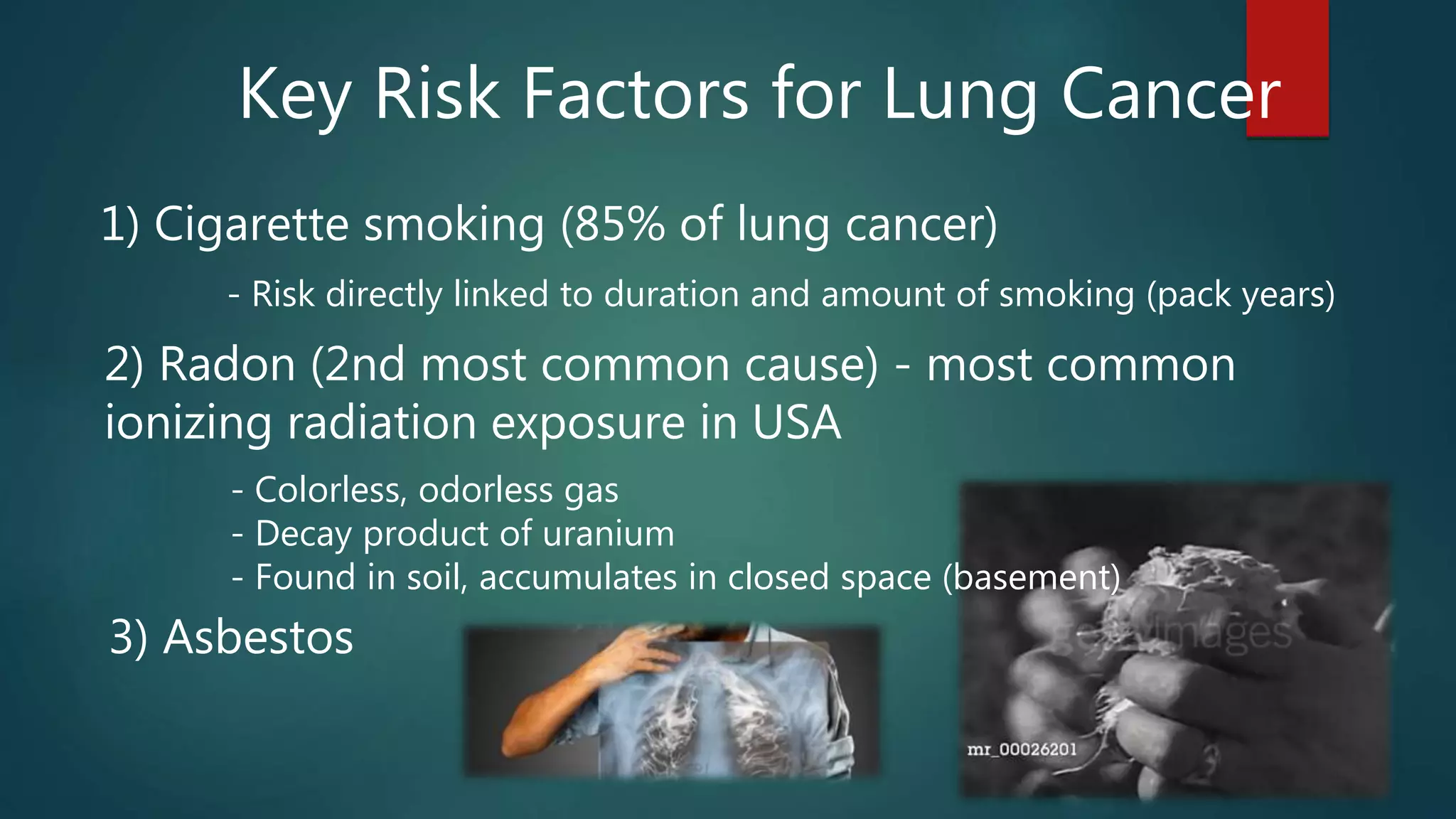 Lung Cancer - Rivin | PPTX