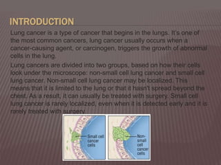 Lung cancer | PPTX
