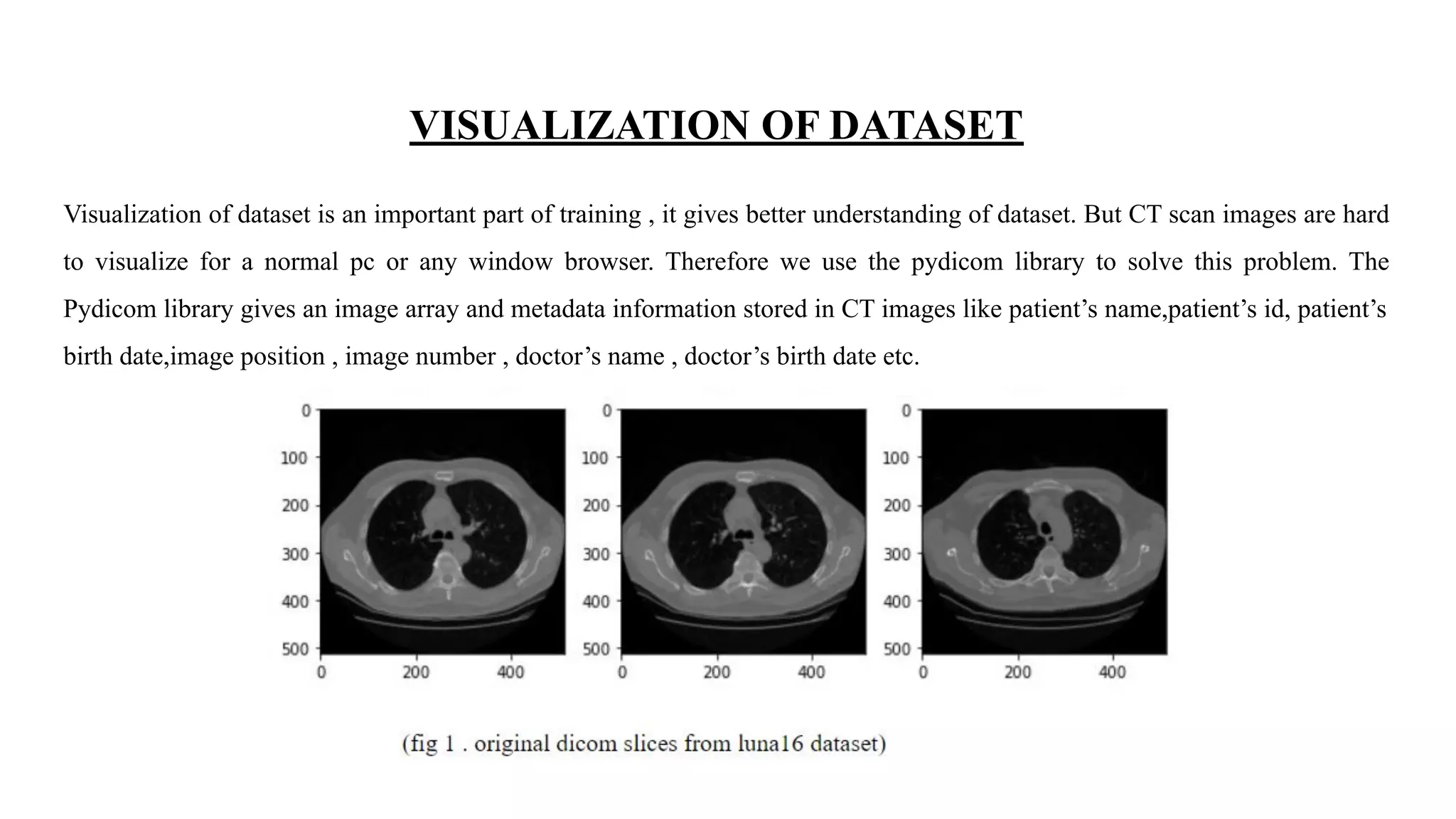 Lung Cancer Detection using transfer learning.pptx.pdf