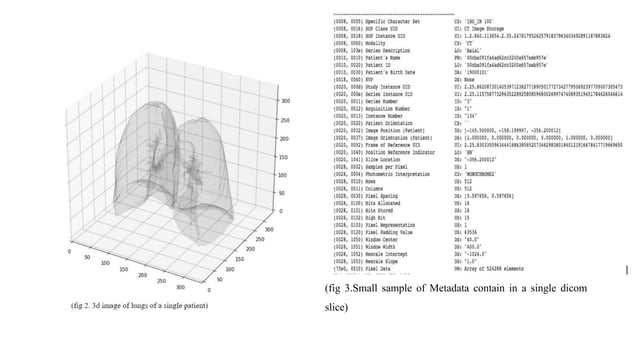 Lung Cancer Detection Using Transfer Learning Pptx Pdf