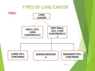Lung cancer | PPT