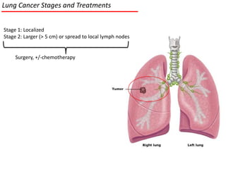 Lung Cancer Stages, Treatments and Targeted Therapies | PPTX