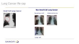 Lung cancer management recommendation in the covid 19 era sanofi | PPTX