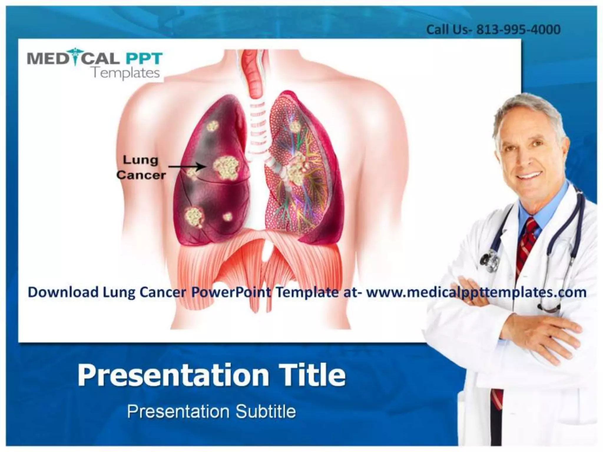 Lung Cancer PowerPoint Template | PPTX | Cancer | Diseases and Conditions
