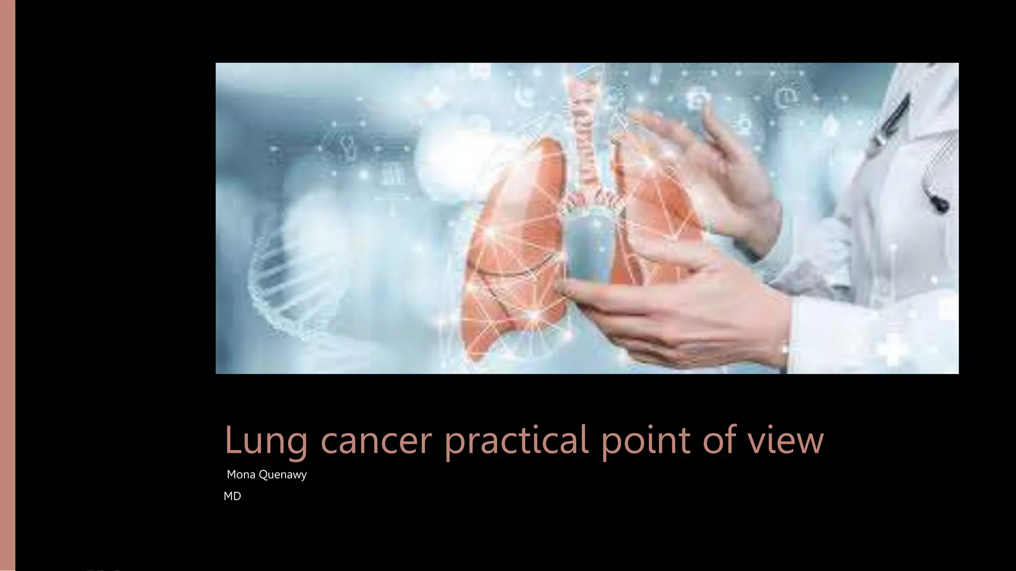 Lung cancer practical point of view.pptx