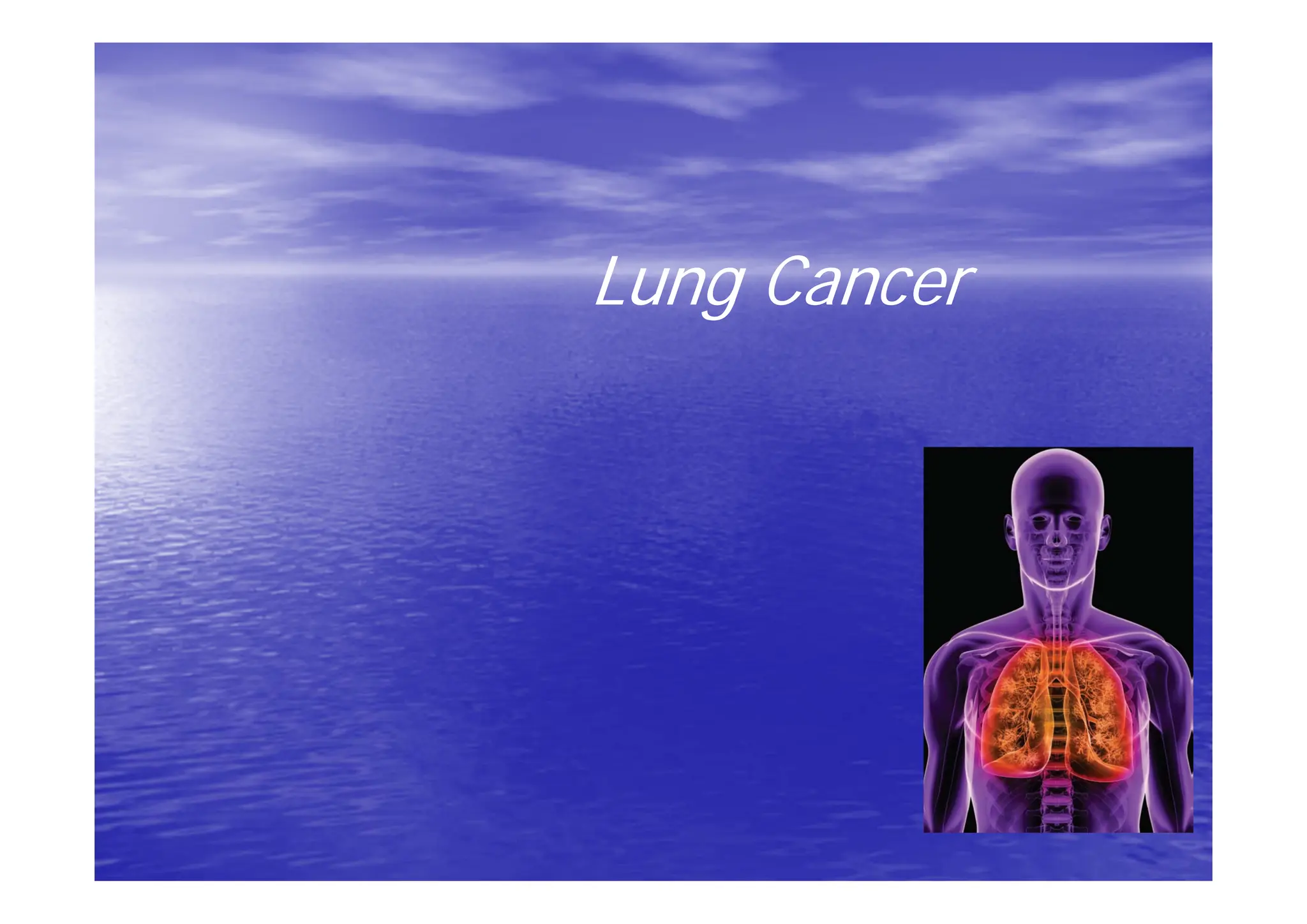 Lung Cancer presentation final.pdf
