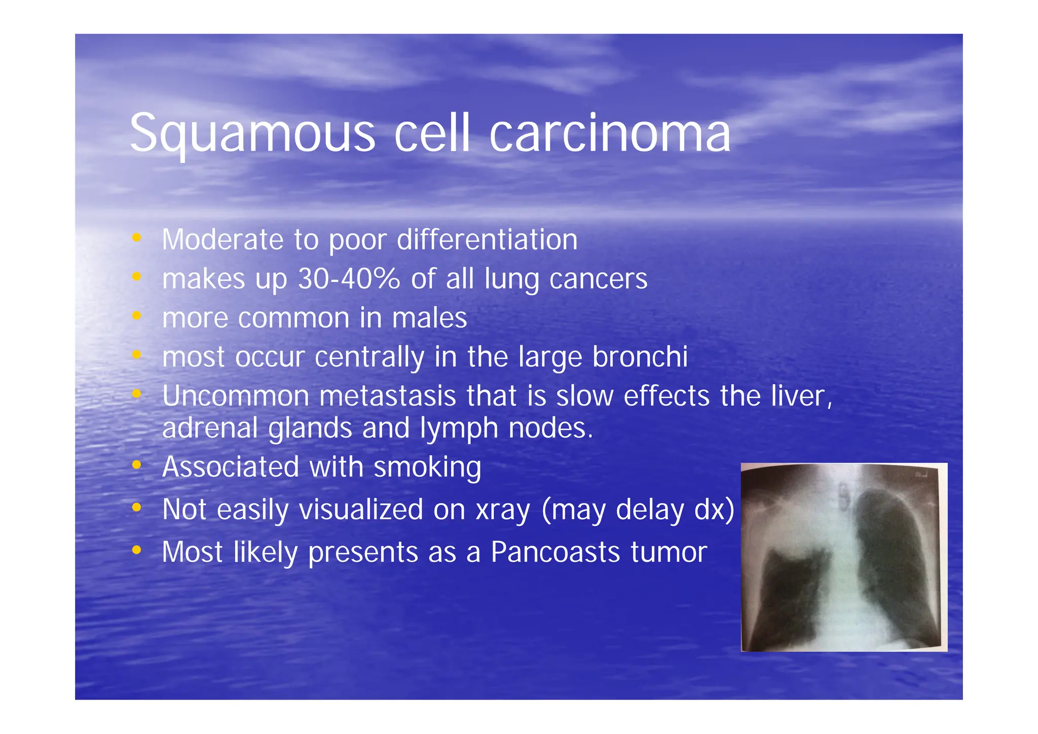 Lung Cancer presentation final.pdf