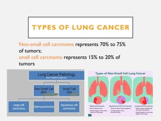 Lung_cancer_presentation- oncology .pptx