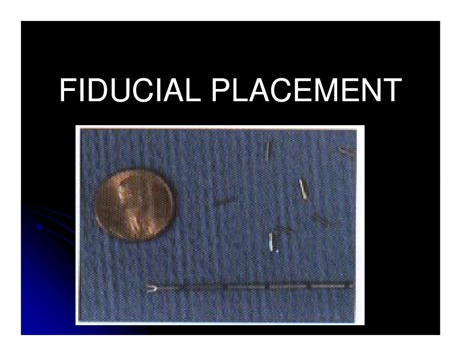 Lung Cancer Radiosurgery
