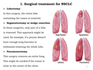 Lung cancer seminar | PPTX