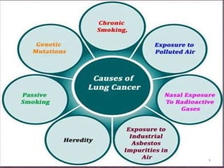 Lung cancer seminar | PPTX