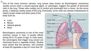 Lung Cancer | PPTX