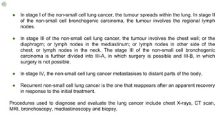 Lung Cancer | PPTX