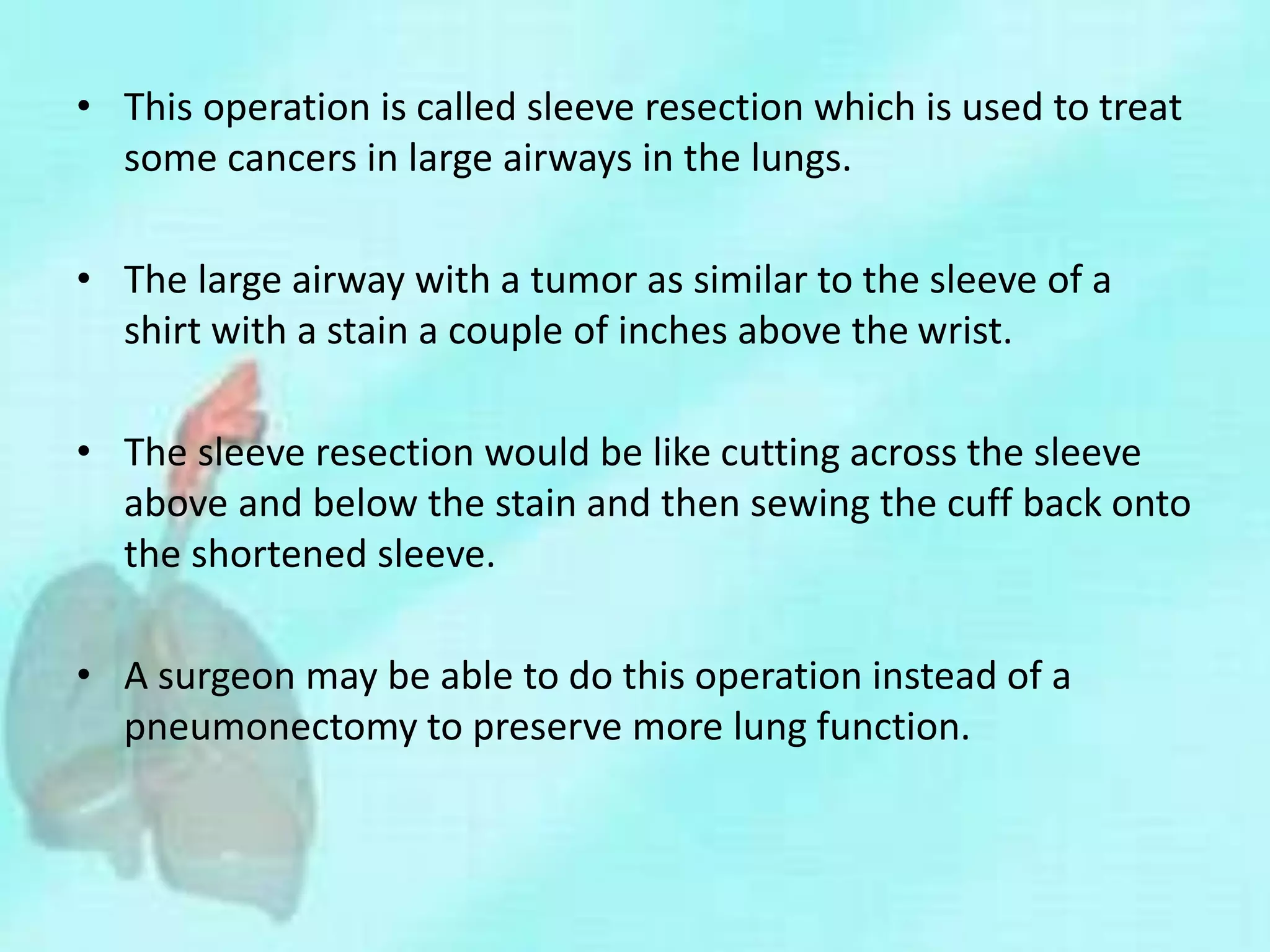 Lung cancer surgery | PPTX