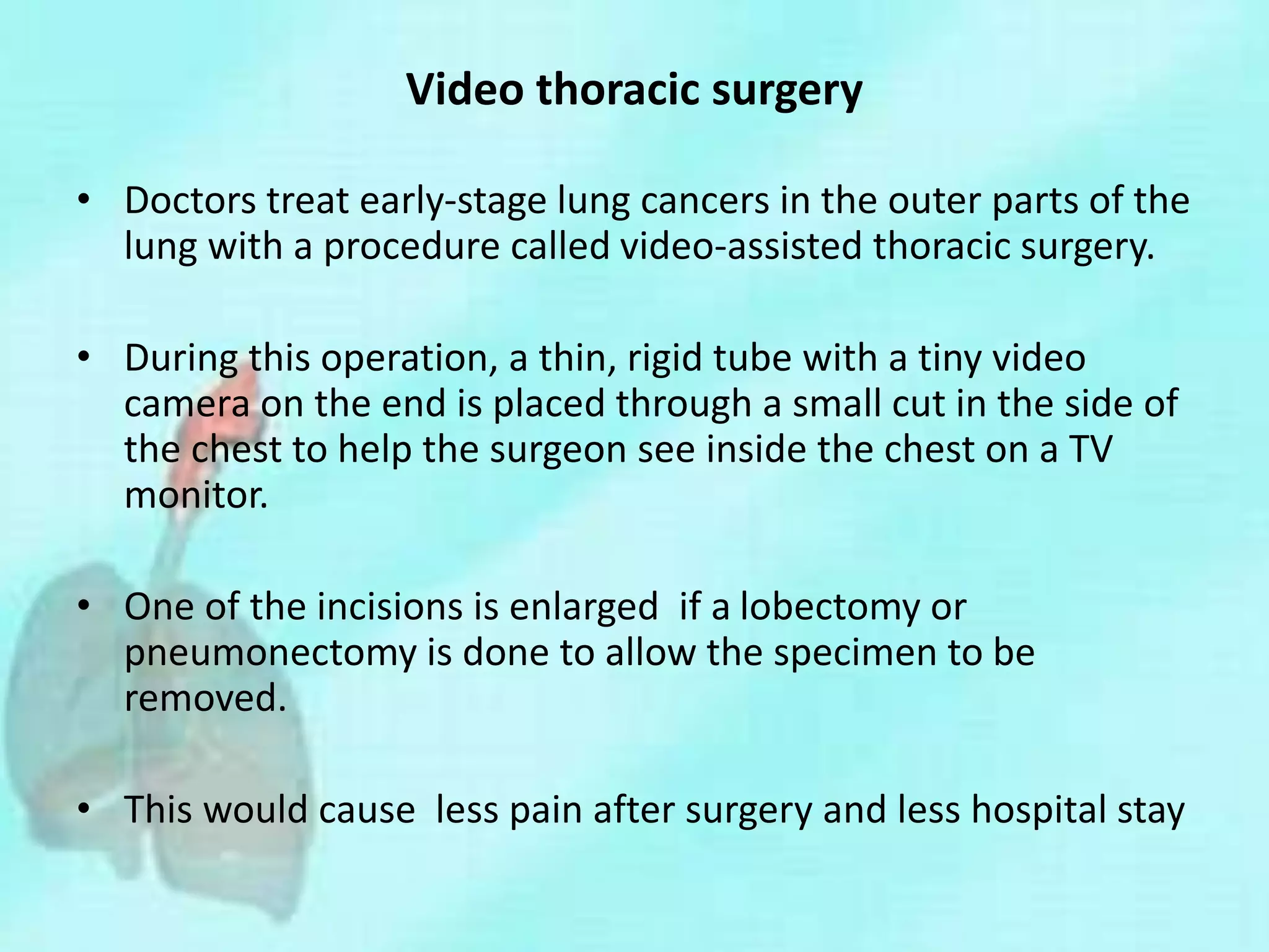 Lung cancer surgery | PPTX