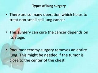 Lung cancer surgery | PPTX