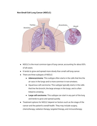 Understanding Lung Cancer Symptoms & Signs | PDF