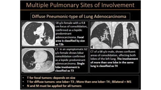 Lung Cancer TNM 8.pptx