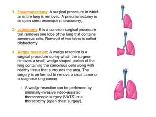 Lung cancer treatment | PPTX