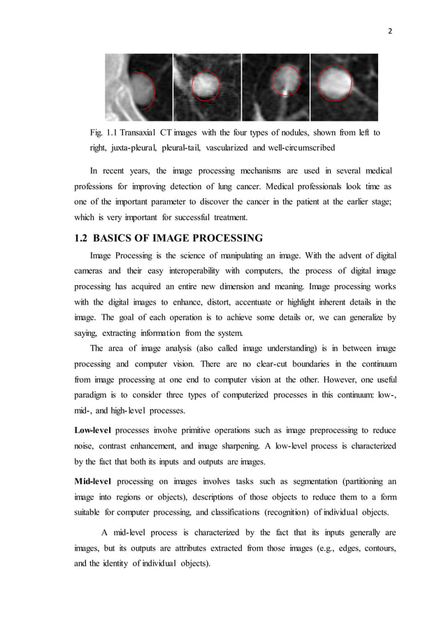 A supervised lung nodule classification method using patch based context analysis in LDCT image ...
