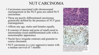 Lung carcinoma 2016 UPDATE | PPTX