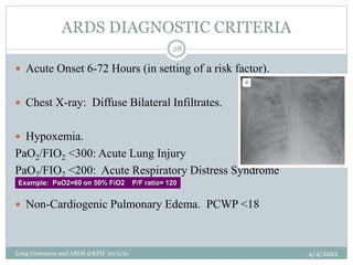 Lung contusion and ARDS | PPTX